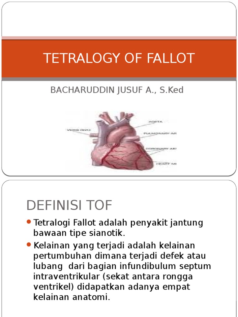 Tetralogy of Fallot | PDF