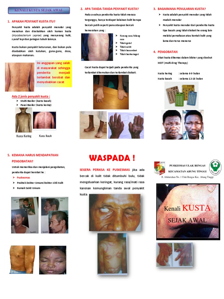 Leaflet Kusta Awam | PDF