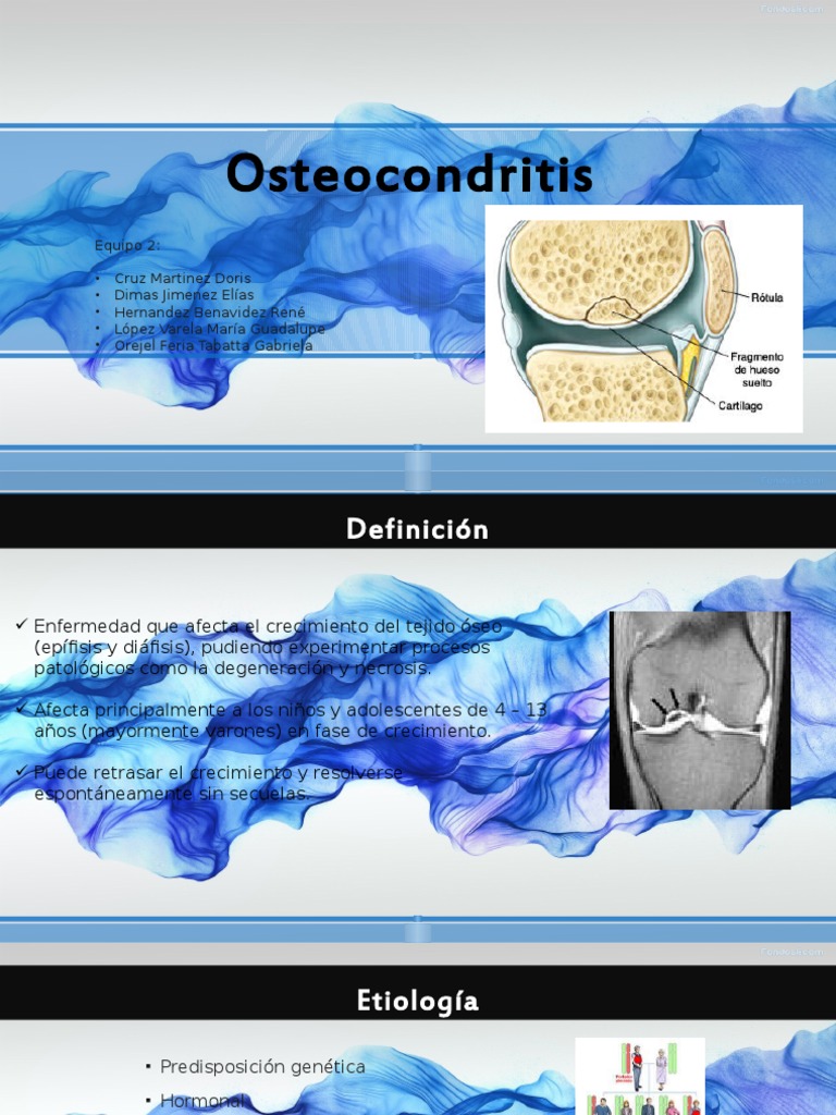 Osteocondritis | Rodilla | Medicina CLINICA