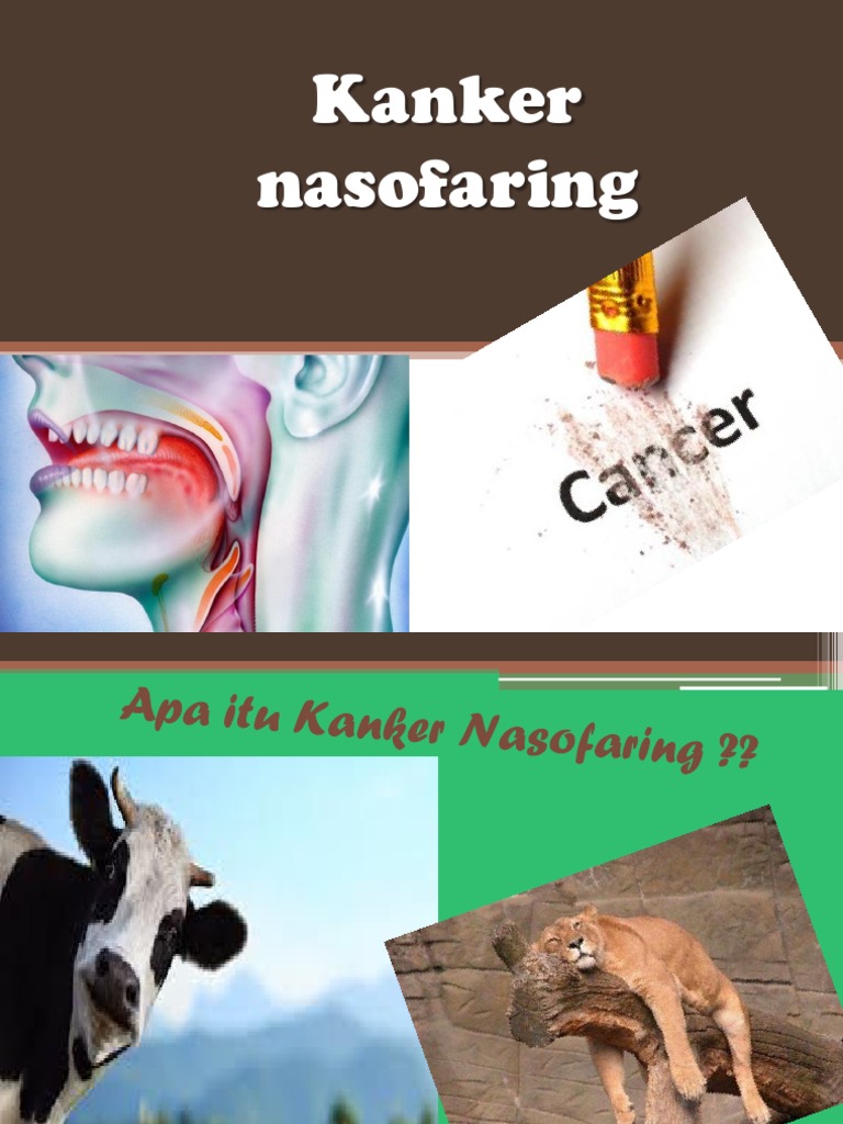 Penyuluhan CA Nasofaring | PDF