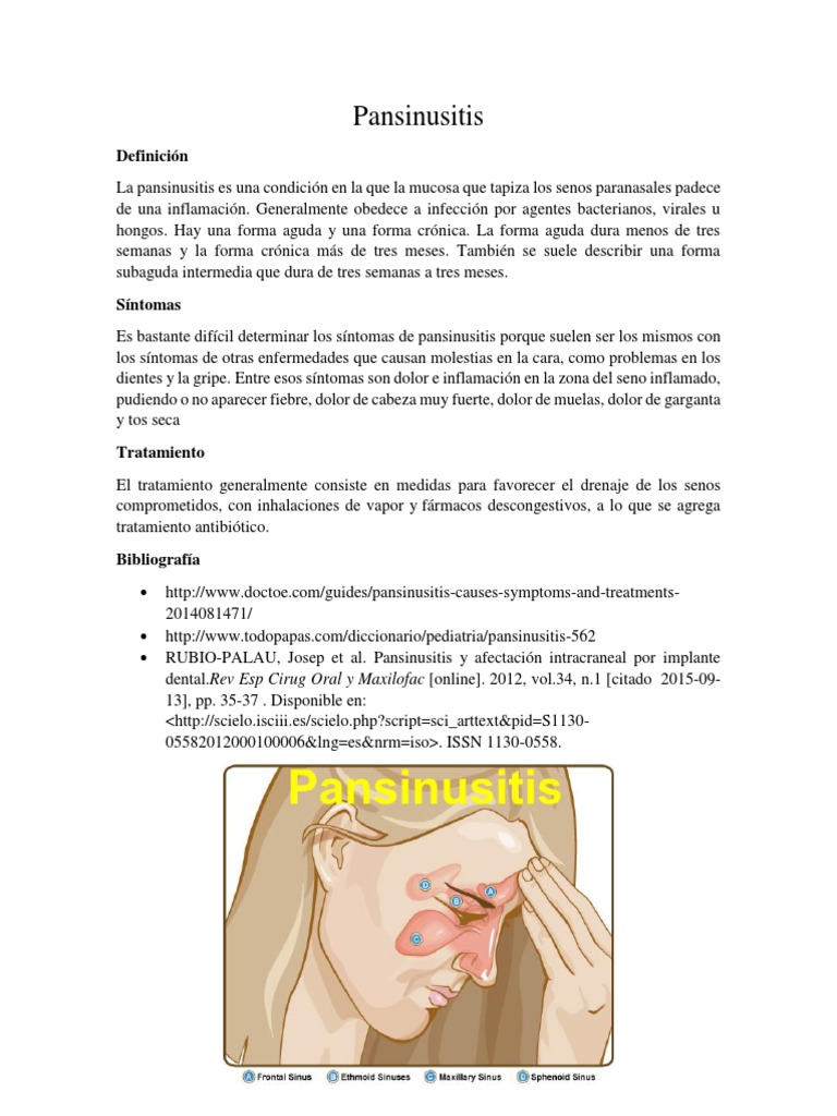 Pan Sinusitis | PDF