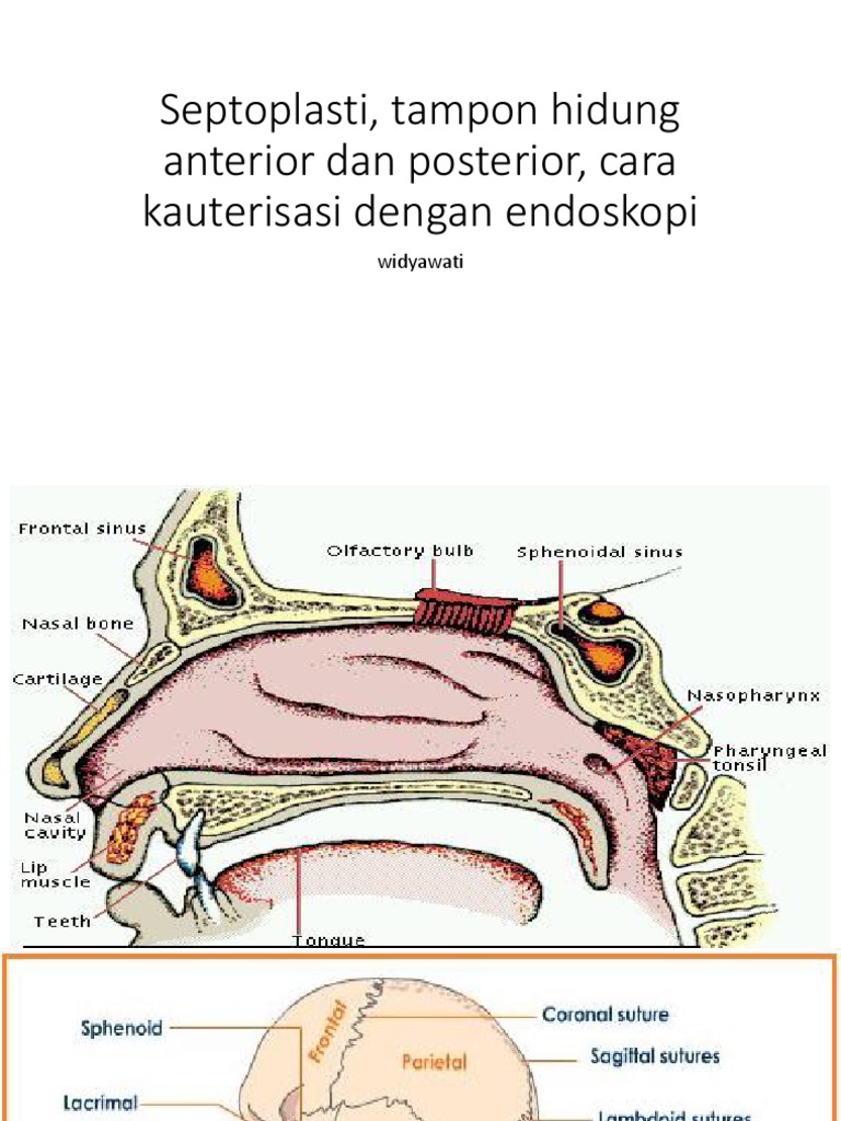 Judul yang Sesuai untuk Dokumen Tentang Prosedur Septoplasti ...