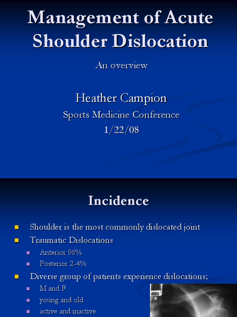 Campion-Management of Acute Shoulder Dislocation | PDF | Anatomical Terms Of Motion | Shoulder