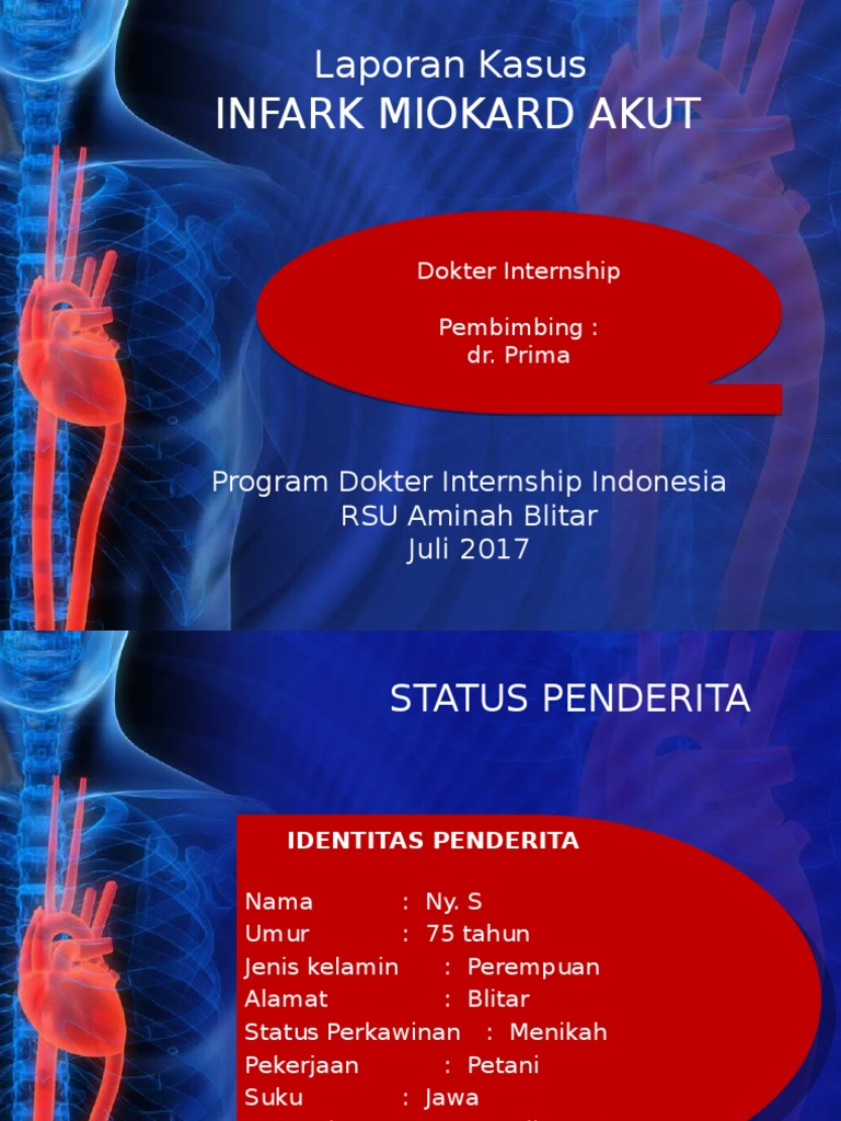 Maju Lapsus IMA Iship | PDF