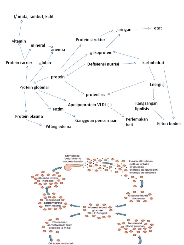 Mind Map Marasmus Kwashiorkor | PDF