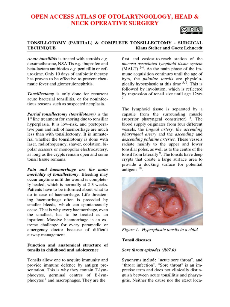 Tonsillotomy _partial_ and Complete Tonsillectomy Surgical Technique ...