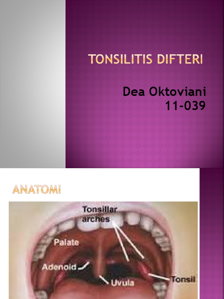 Tonsilitis Difteri | PDF