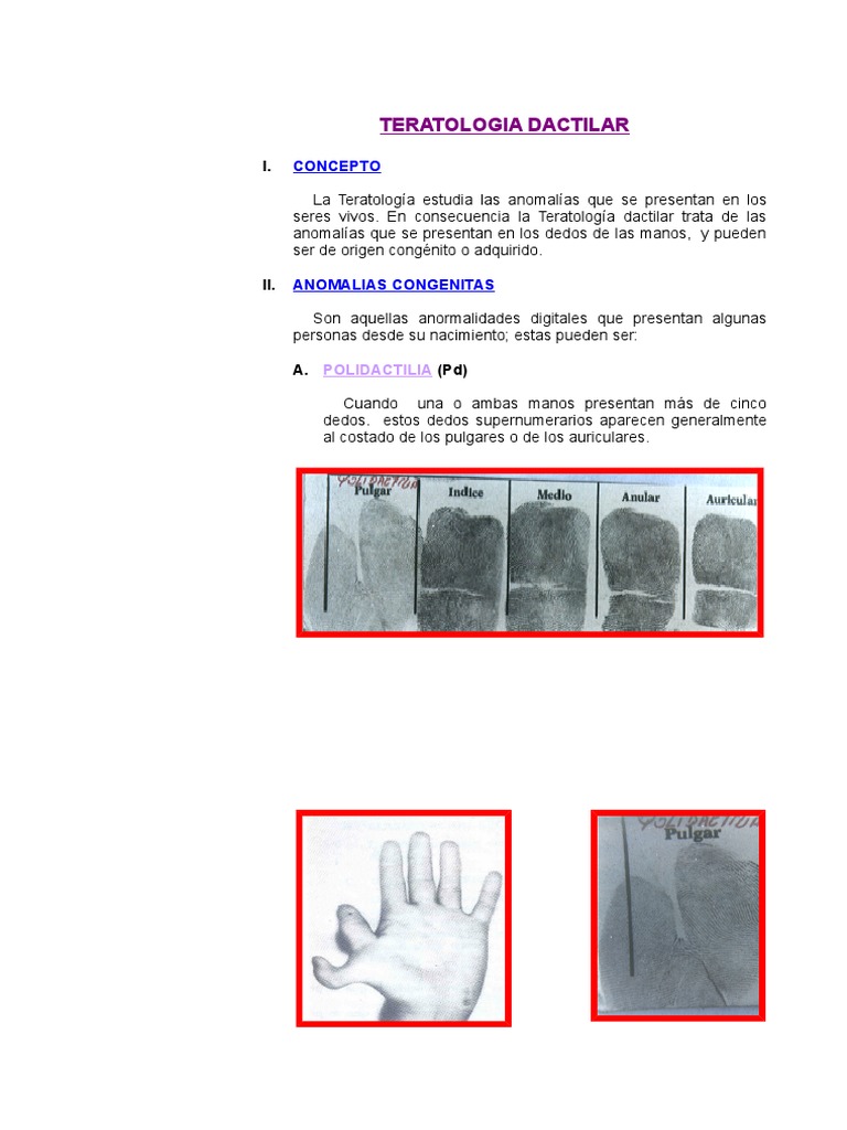 Teratologia Dactilar | PDF | Huella dactilar | Enfermedades y trastornos