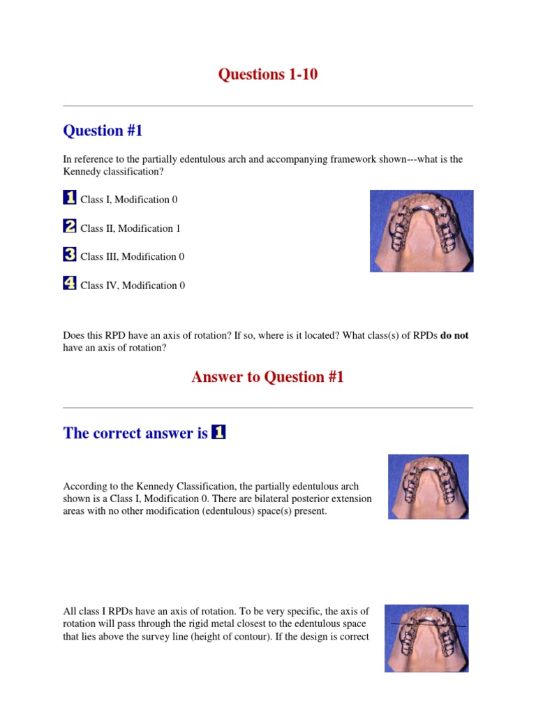 RPD Review Questions | PDF | Dentures | Dentistry Branches