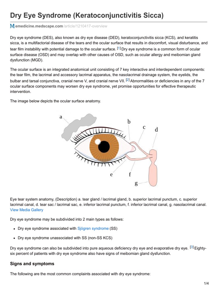 Dry Eye Syndrome Keratoconjunctivitis Sicca | Medical Specialties ...