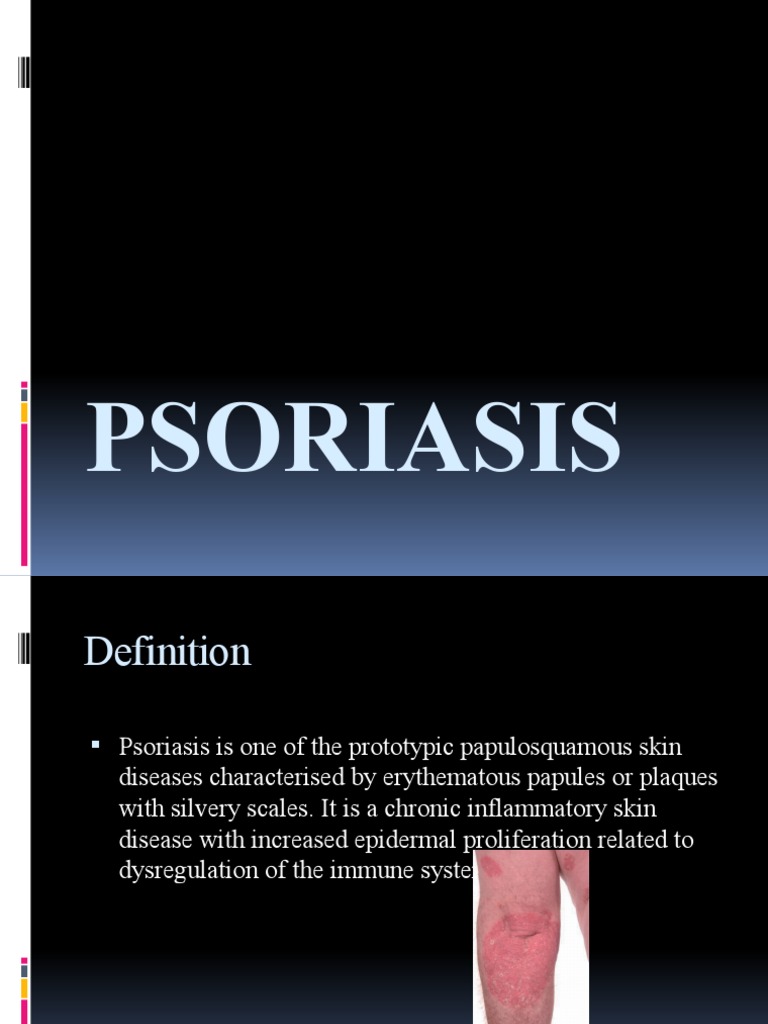 A Comprehensive Overview of Psoriasis: Definitions, Clinical ...
