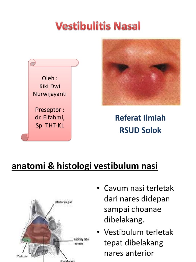 308642633-Vestibulitis-Nasal.pptx