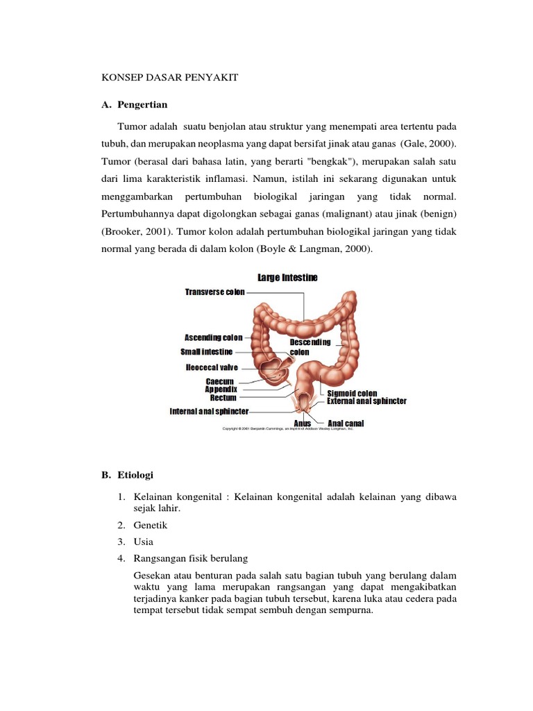 LP Tumor Colon | PDF