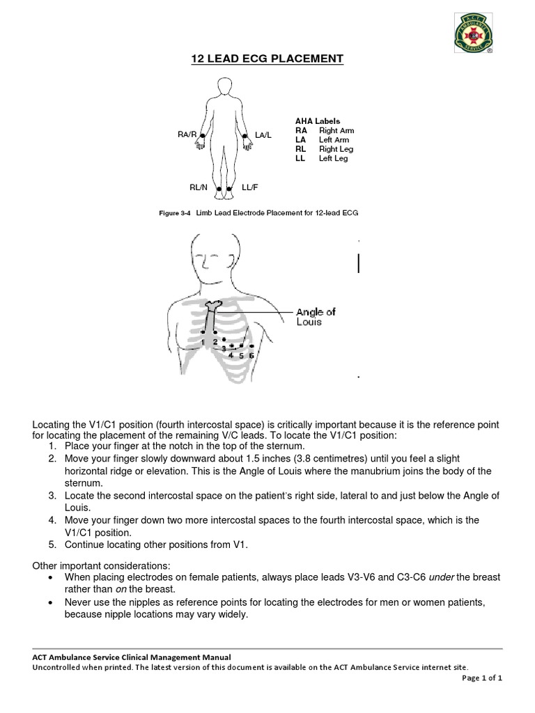12 Lead Ecg Placement: ACT Ambulance Service Clinical Management Manual ...
