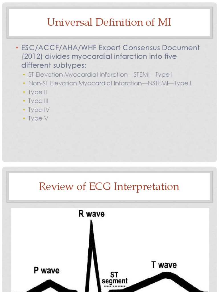 Ekg Acs | PDF | Percutaneous Coronary Intervention | Myocardial Infarction