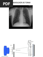 Radiografía de Tórax Normal - Patrón Intersticial | PDF | Pulmón | Tórax