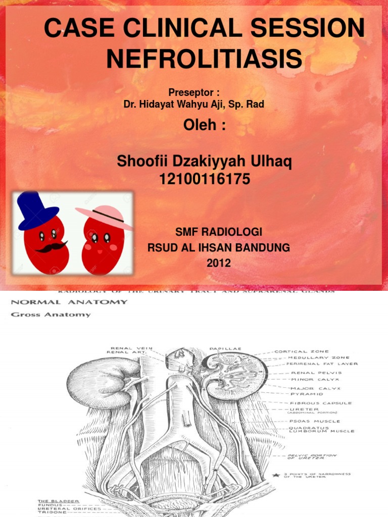 Css Nefrolitiasis | PDF