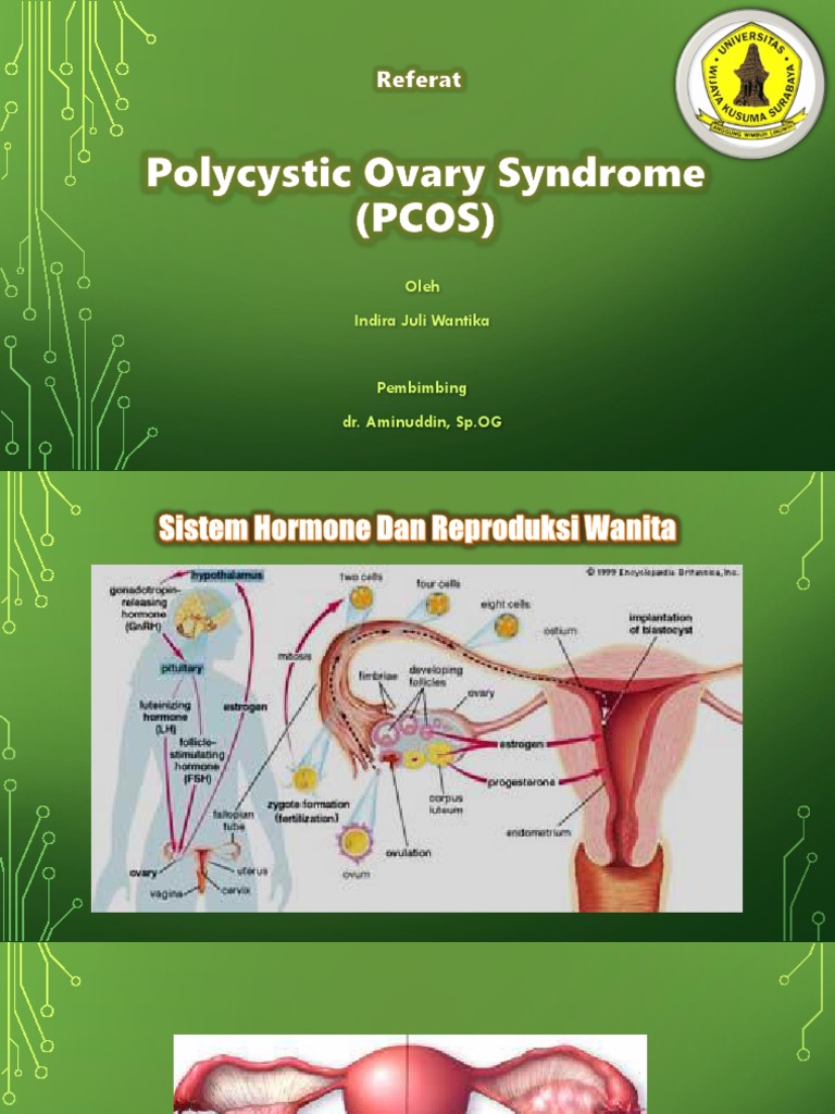 Polycystic Ovary Syndrome (PCOS) | PDF