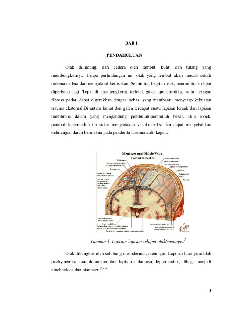Epidural Dan Subdural Hematom PDF | PDF