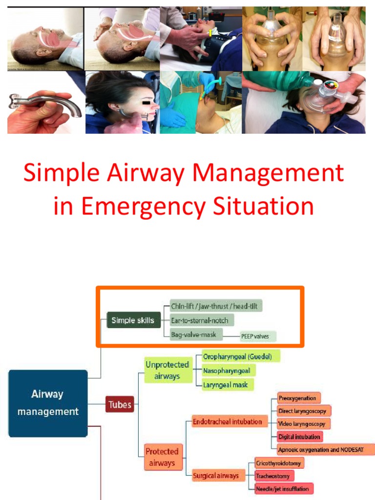 4 - Simple Airway Management in Emergency Situation PDF | PDF ...