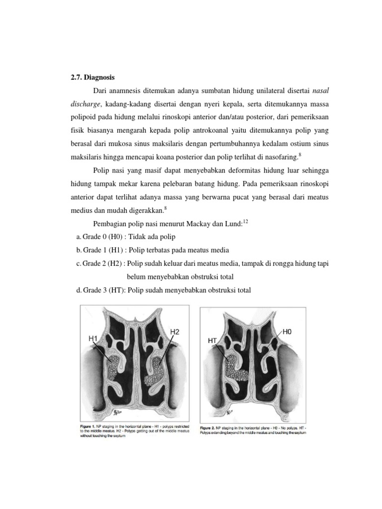 Staging Polyp | PDF