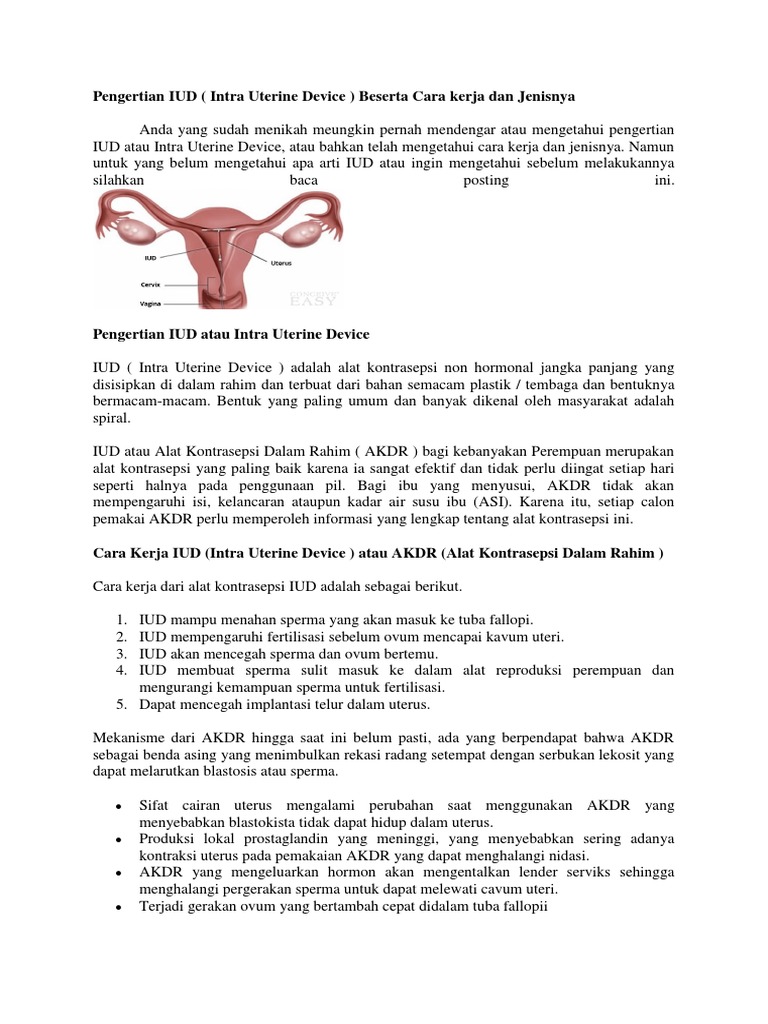 Mekanisme dan Jenis IUD Kontrasepsi | PDF | Gaya Hidup