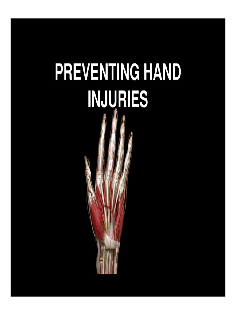 Preventing Hand Injuries PDF | PDF | Polyvinyl Chloride | Blade