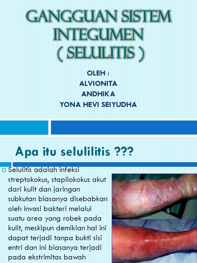 Selulitis | PDF | Sains & Matematika
