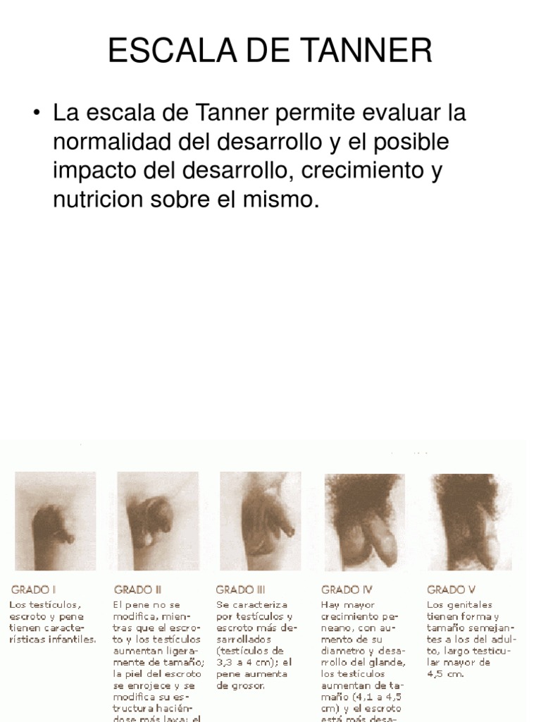 Escala de Tanner 22 | PDF