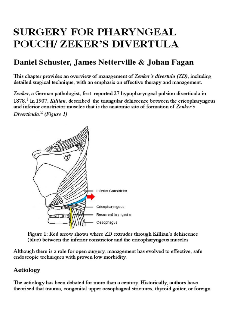 Surgery For Pharyngeal Pouch or Zekers Divertula | PDF | Esophagus ...