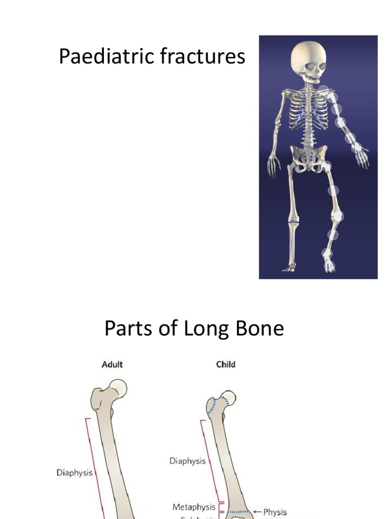 Paediatric Fractures | PDF | Elbow | Bone