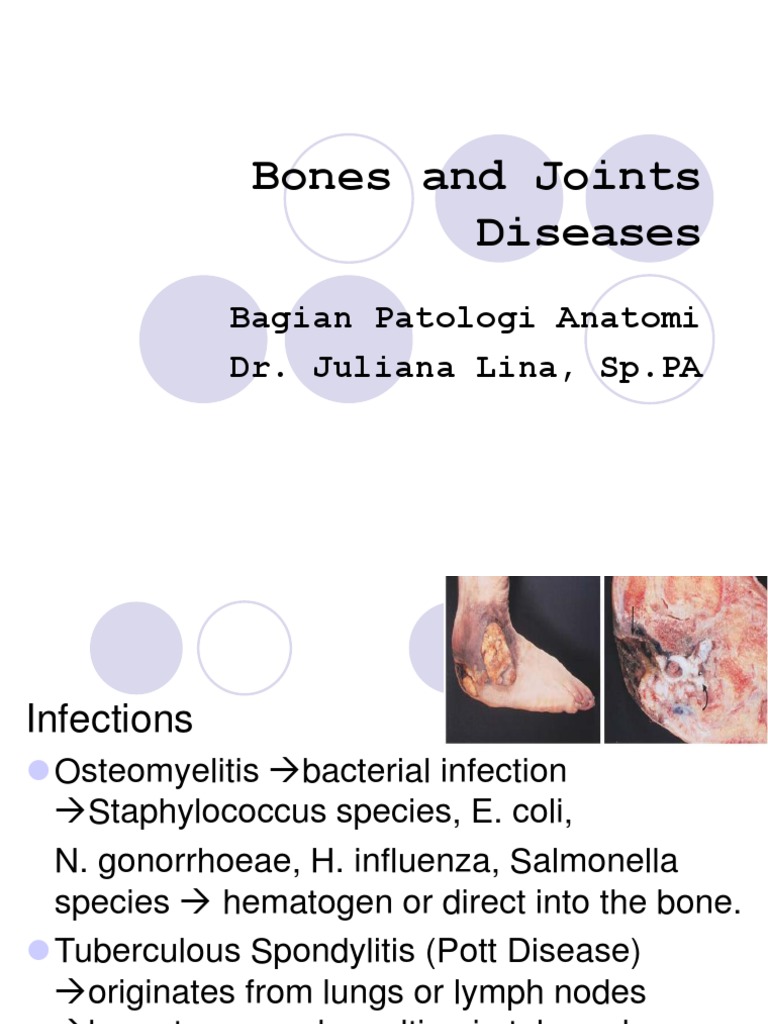 Bones and Joints: Diseases Overview | PDF | Gout | Bone
