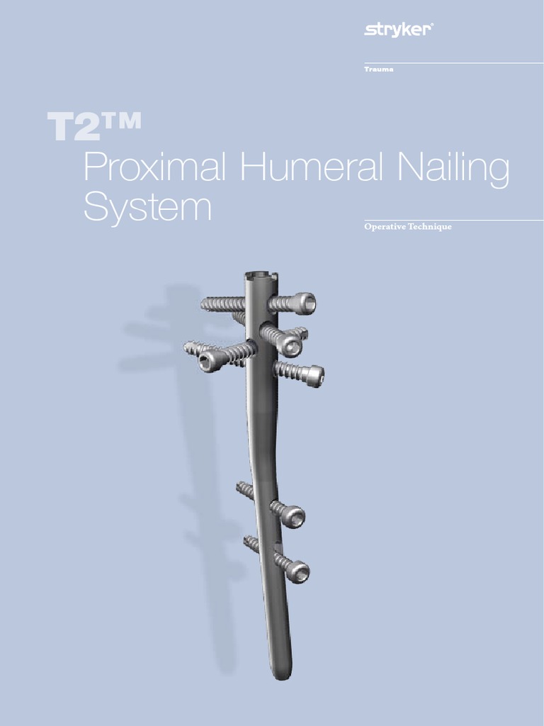 Proximal Humeral Nailing System | PDF | Orthopedic Surgery | Screw