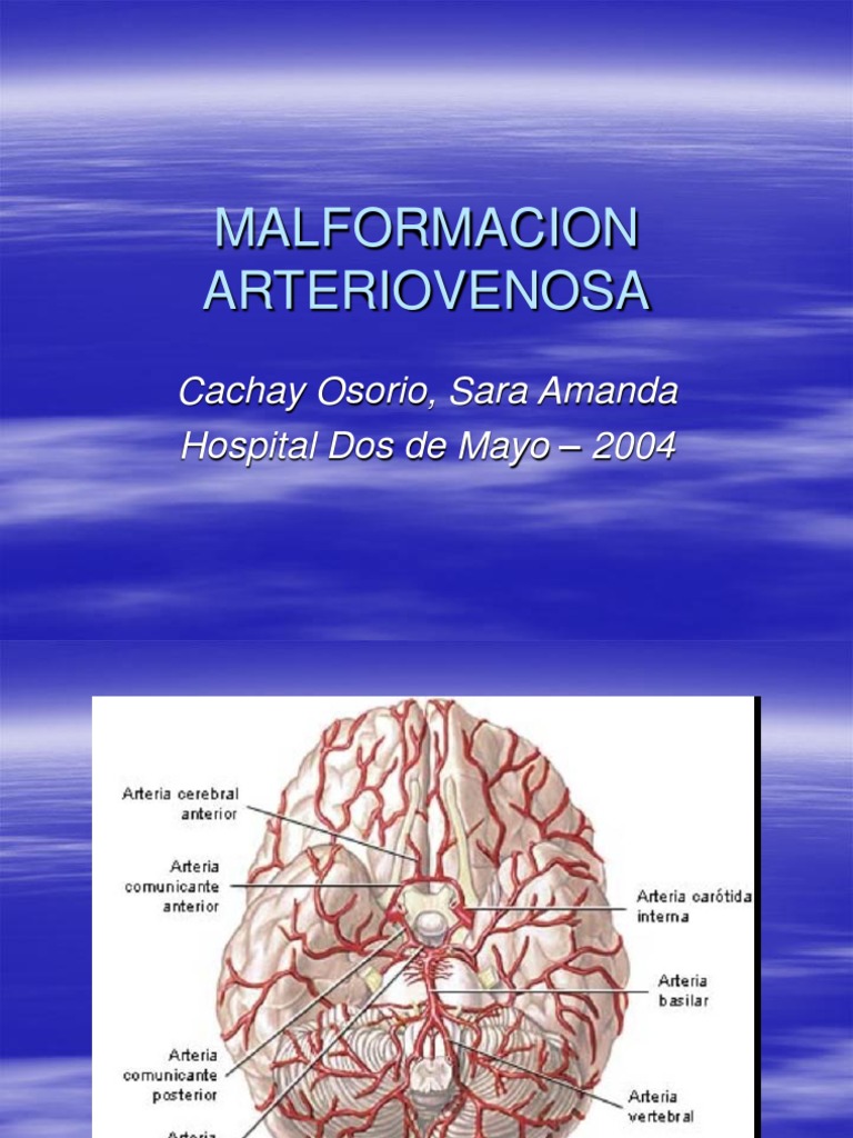 Mav 2 | PDF | Angiografía | Vena