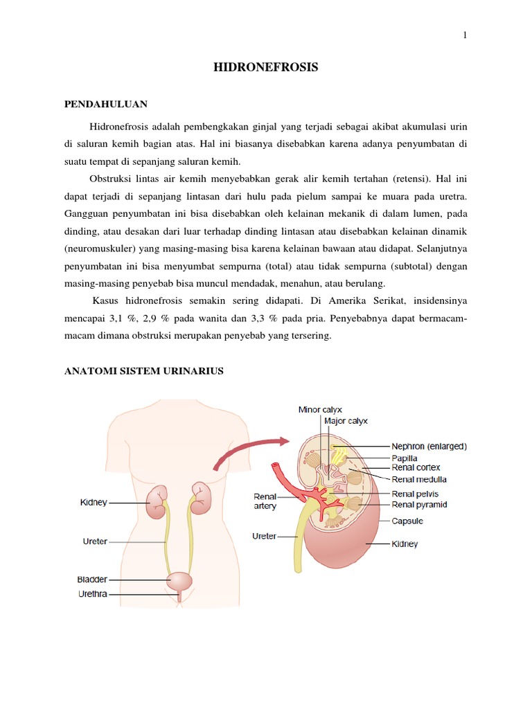 Hidronefrosis.docx