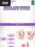 PANDUAN PRAKTIK KLINIS Prolaps Uteri | PDF