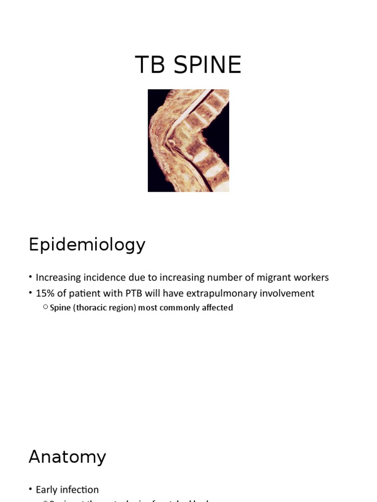 TB Spine | Download Free PDF | Vertebral Column | Spinal Cord