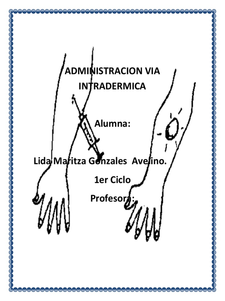 Administracion Via Intradermica | PDF | Inyección (medicina ...