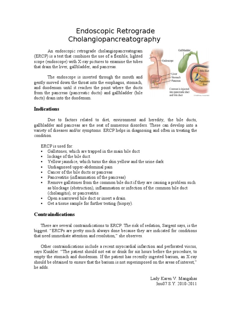 Endoscopic Retrograde Cholangiopancreatography (ERCP) | PDF ...