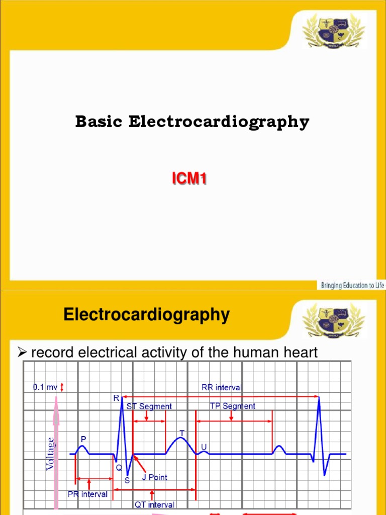 Basic ECG | PDF