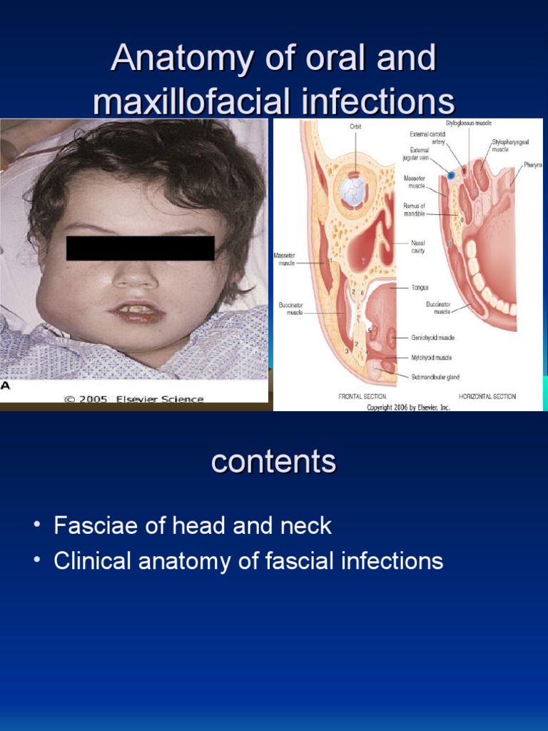 Anatomy of Oral and Maxillofacial Infections | PDF | Neck | Dentistry ...