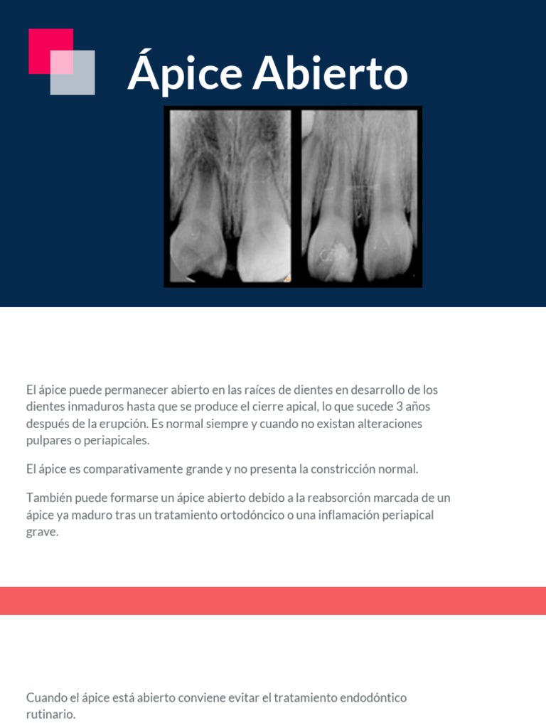 Endodoncia Apice Abierto | Especialidades Medicas | Enfermedades y ...