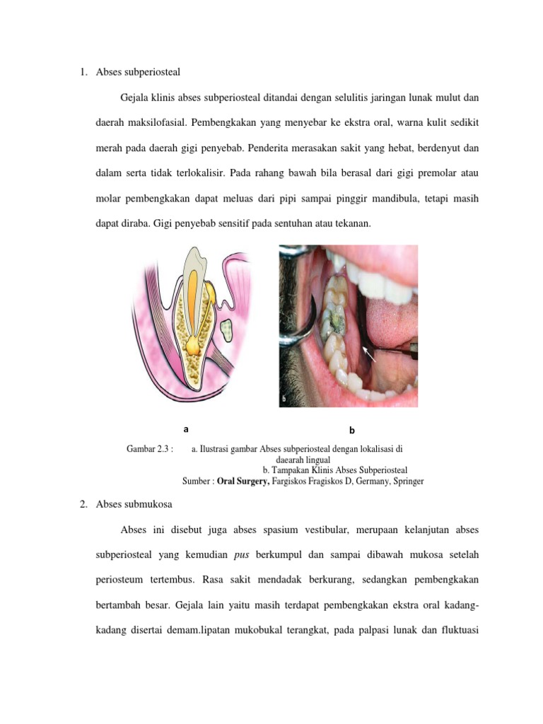Abses Subperiosteal | PDF