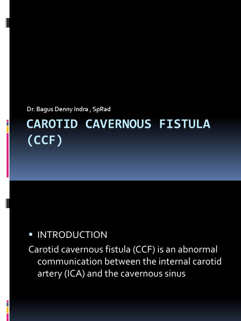Carotid Cavernous Fisstula (CCF) | PDF | Angiography | Angiology