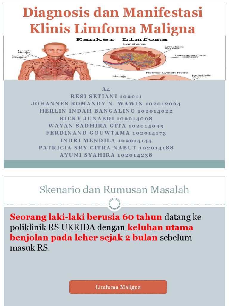 Limfoma Maligna PPT Blok 24 | PDF