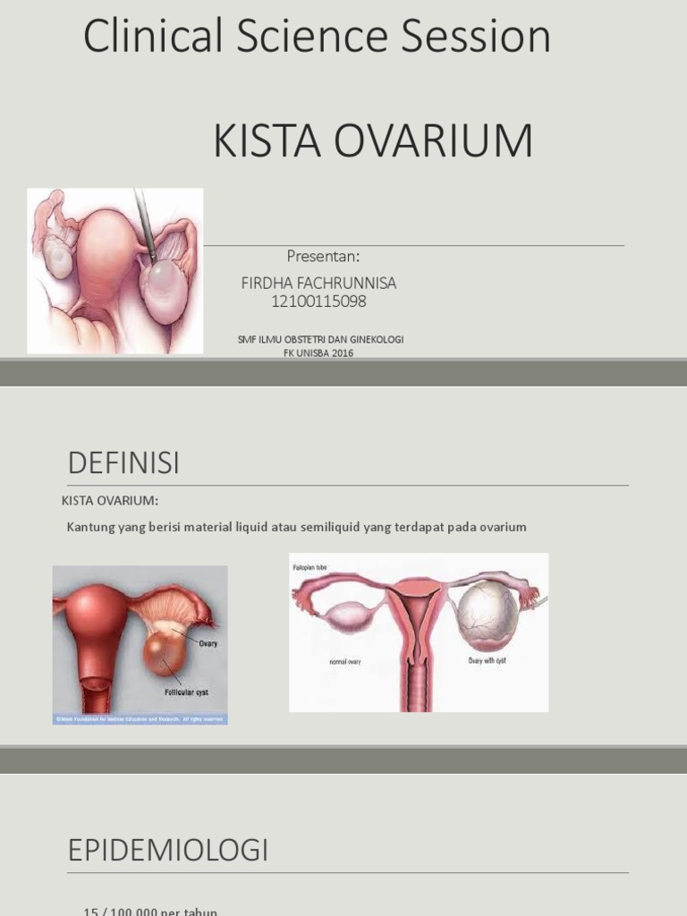 Css Kista Ovarium | PDF