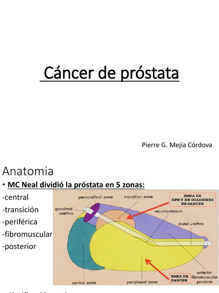 Guía Completa sobre Cáncer de Próstata | PDF | Antígeno específico de ...