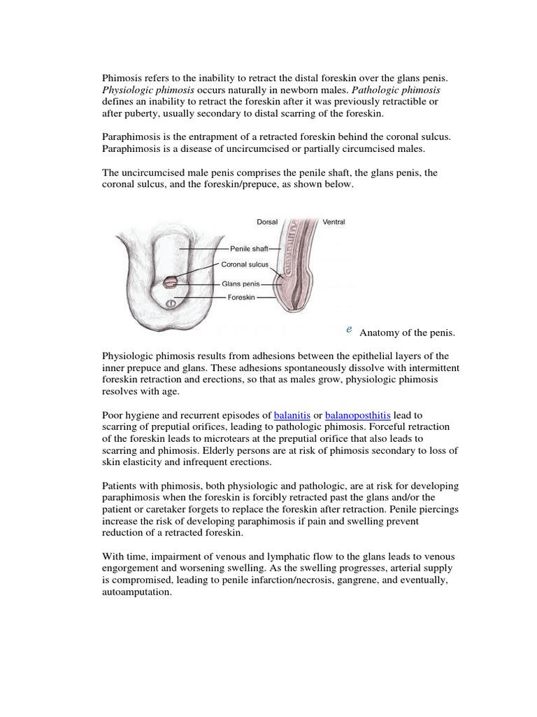 Phimosis | PDF | Circumcision | Urology