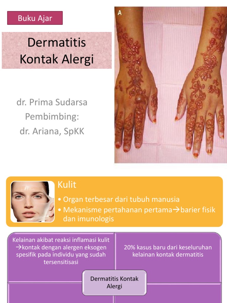 Dermatitis Kontak Alergi | PDF