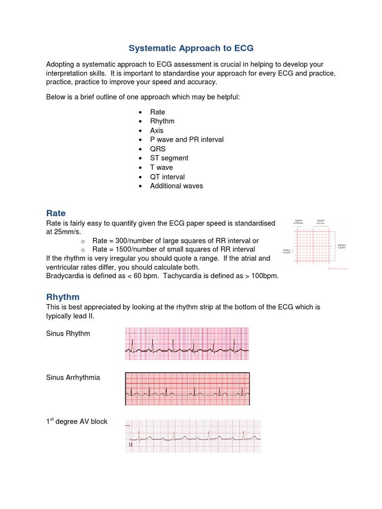 Systematic ECG Interpretation Guide | PDF | Electrocardiography | Cardiac Arrhythmia